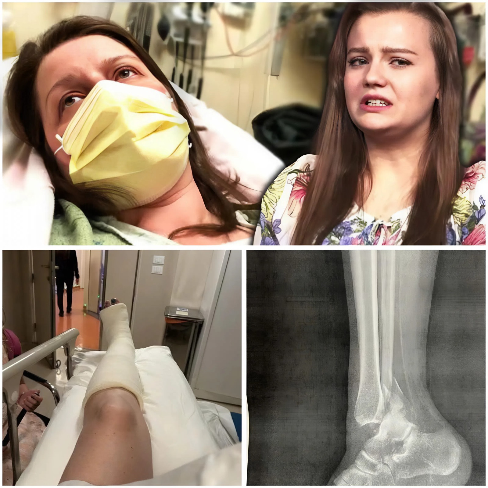 Robyn’s Devastating Fall: Hospitalized With a Broken Leg, Family ...